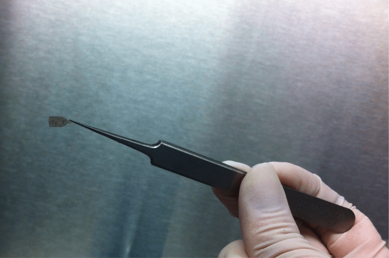 Tiny eye implant could restore vision lost to macular degeneration