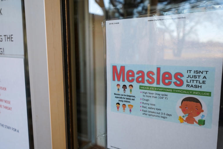 Virginia child with measles traveled through Maryland, officials say