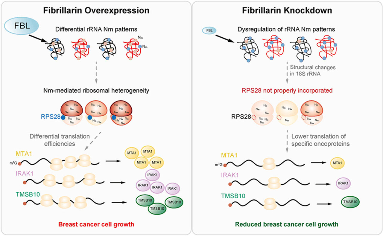 How aggressive breast cancer controls protein production