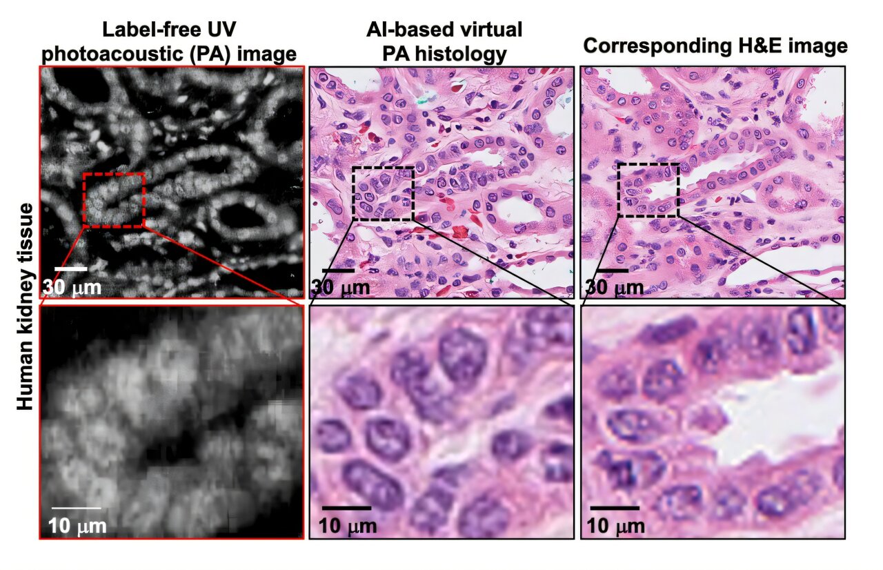Intraoperative tumor histology may enable more-effective cancer surgeries