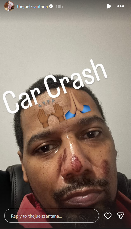 Juelz Santana reveals facial injuries from recent car crash