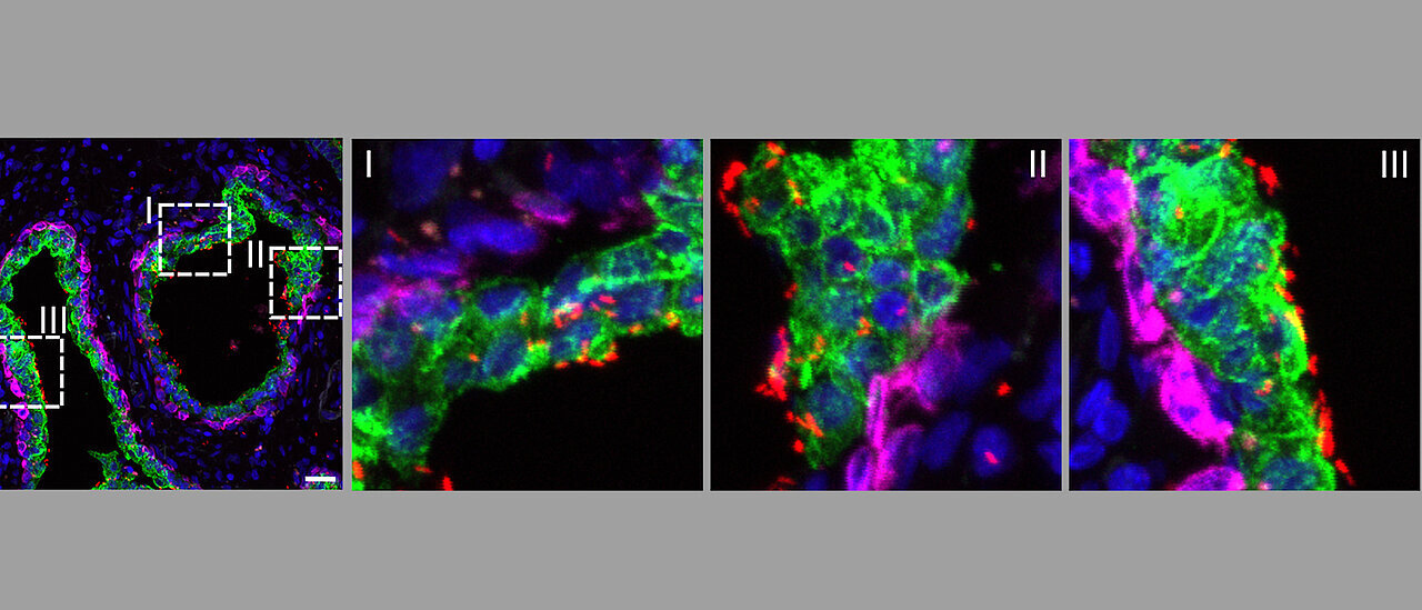 Researchers uncover how E coli bacteria sneak into the prostate