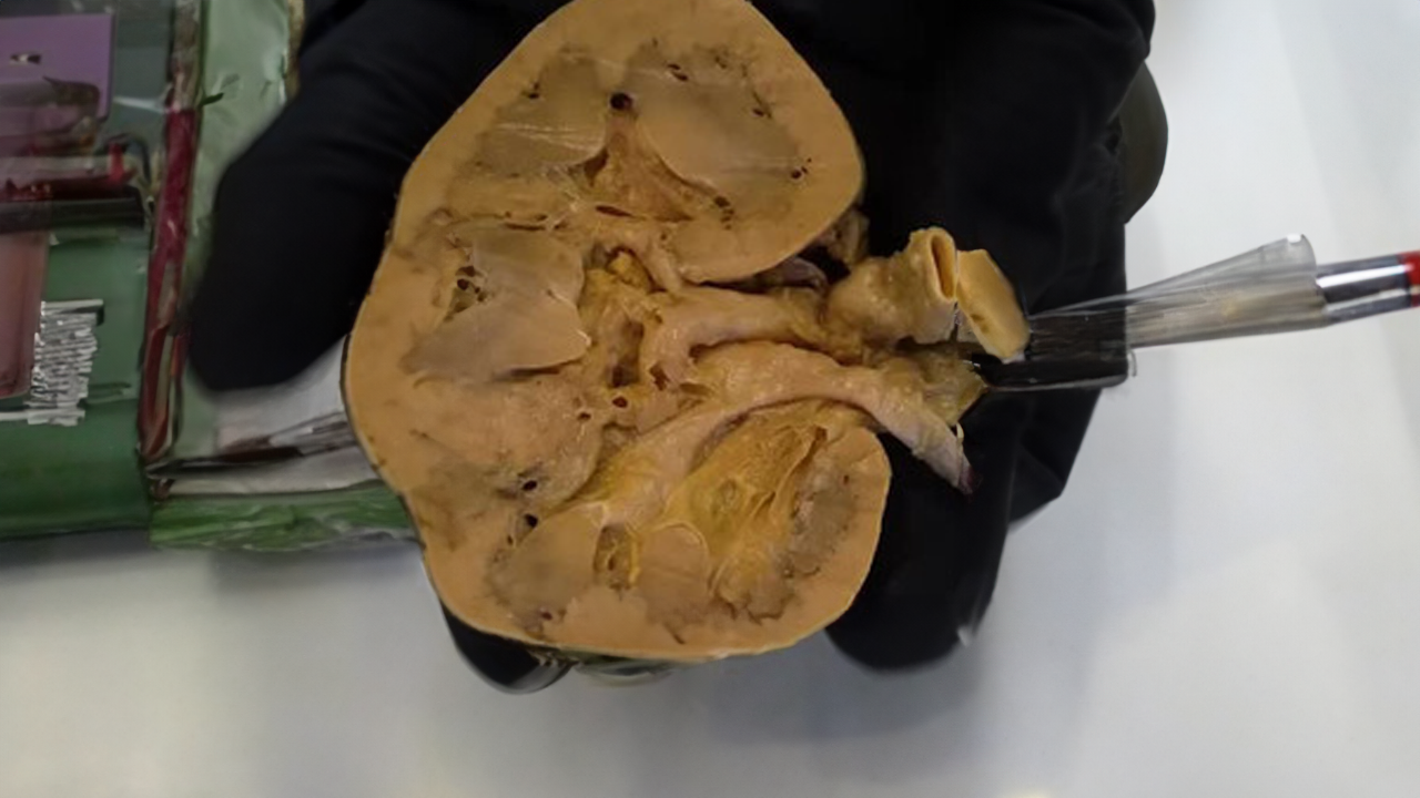 Does caffeine actually make you urinate more?