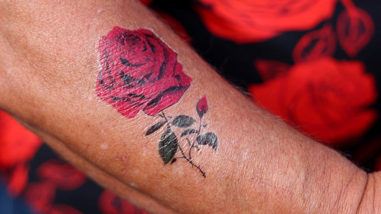 Shocking reason for man’s terrifying medical mystery revealed