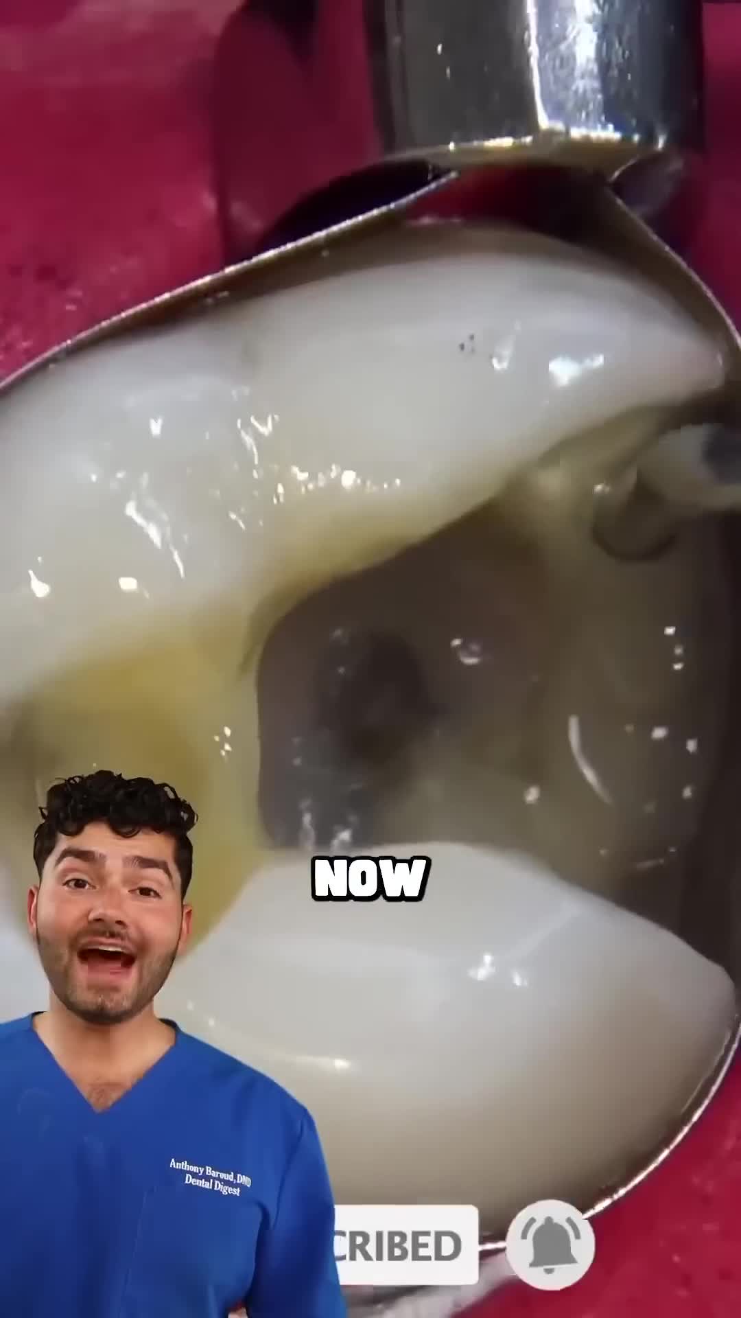 Dentist explains: How to fix a cavity