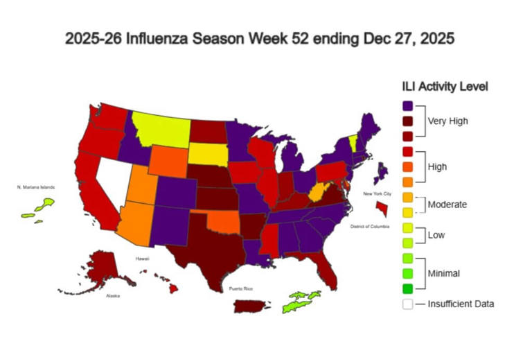 New map shows where the super flu is spreading fastest across the US