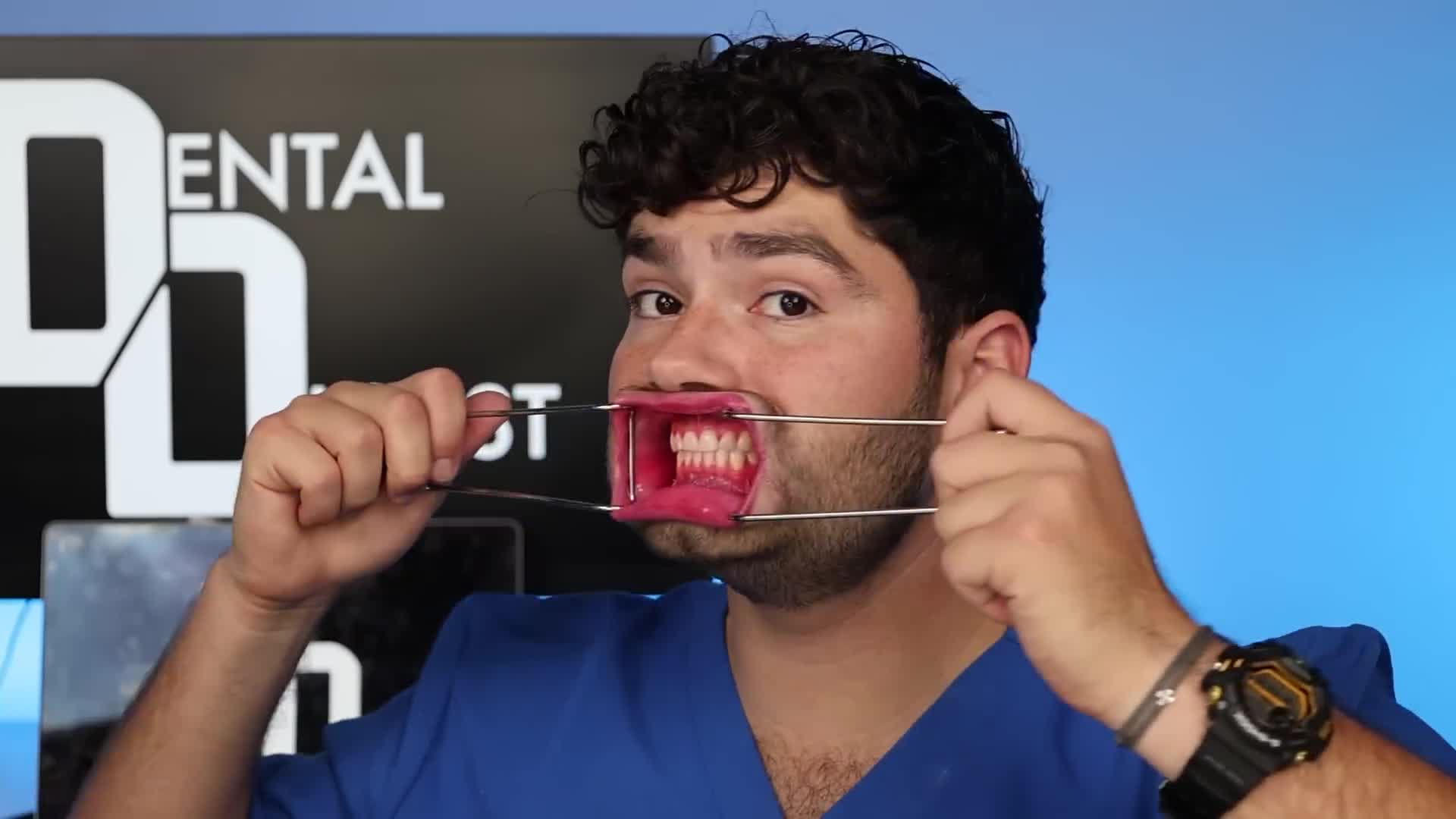 Pink vs blue cavity battle?