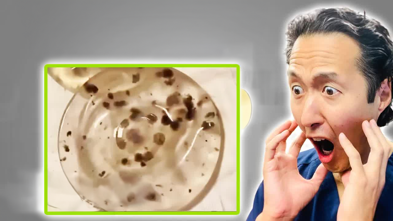 Plastic surgeon reacts to black mold found in breast implants