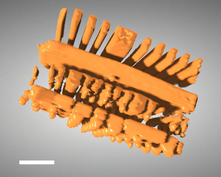 Novel AI method sharpens 3D X-ray vision