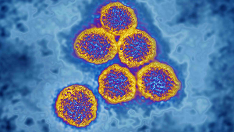 Urgent alert over rare brain virus in NSW