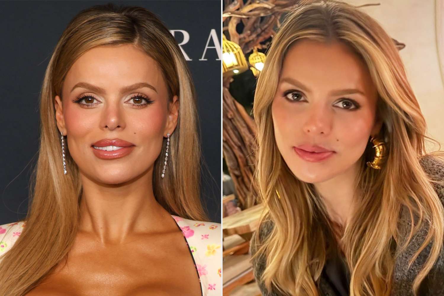 Brooks Nader shares a candid look at her lips after getting filler ...