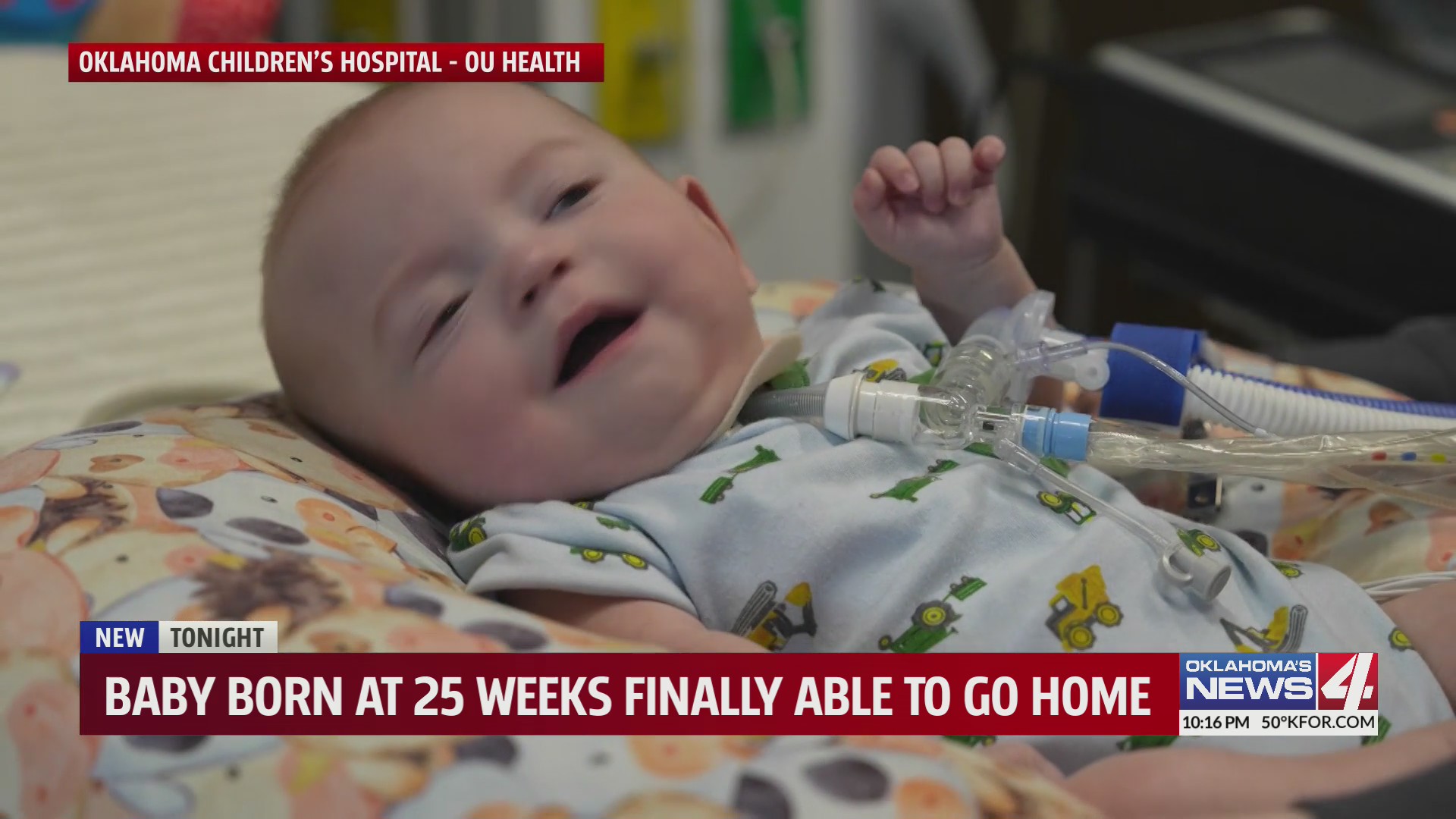 Baby born at 25 weeks finally able to go home