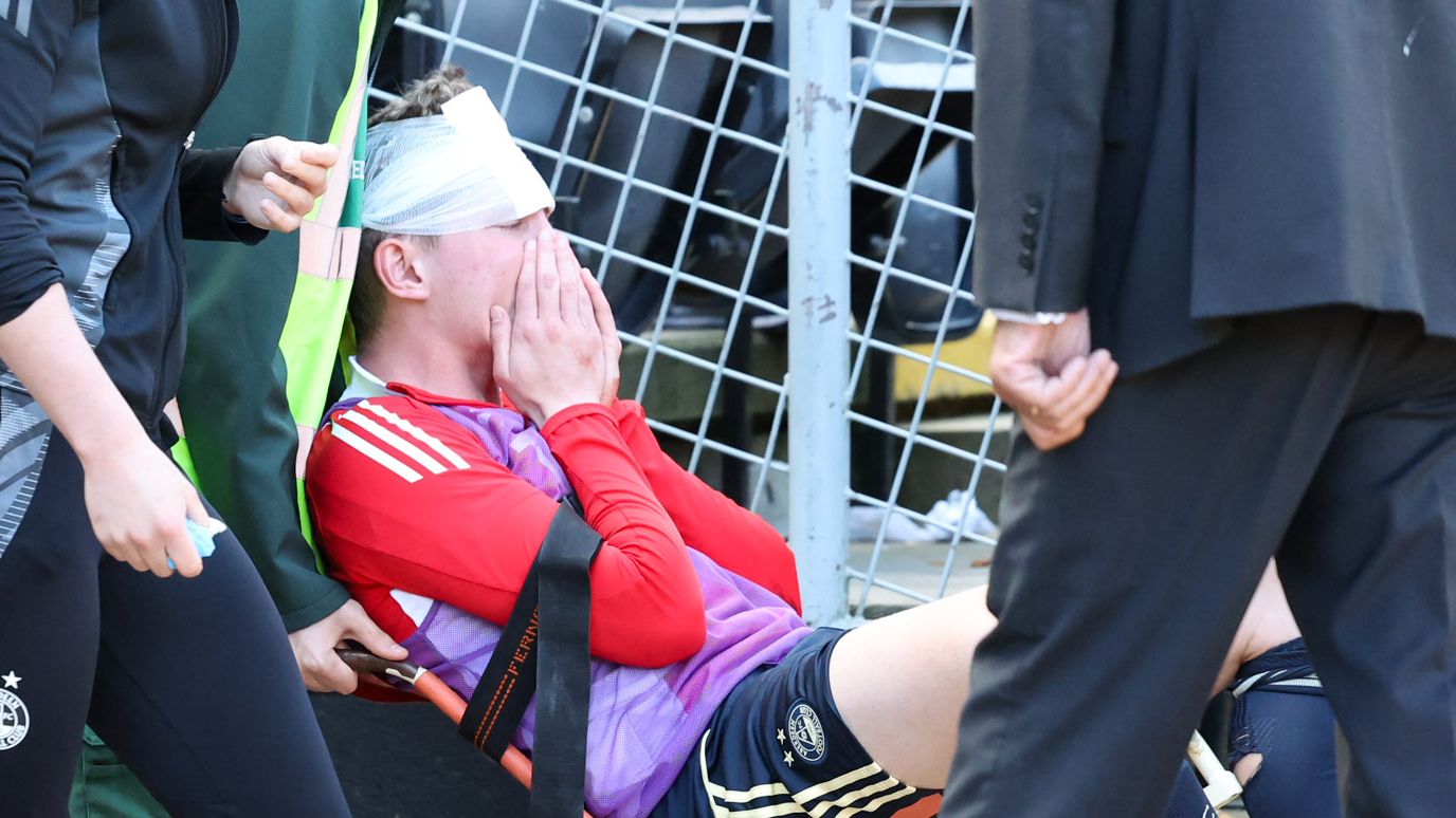 Supporter moet 18 maanden cel in na ernstig verminken van eigen speler