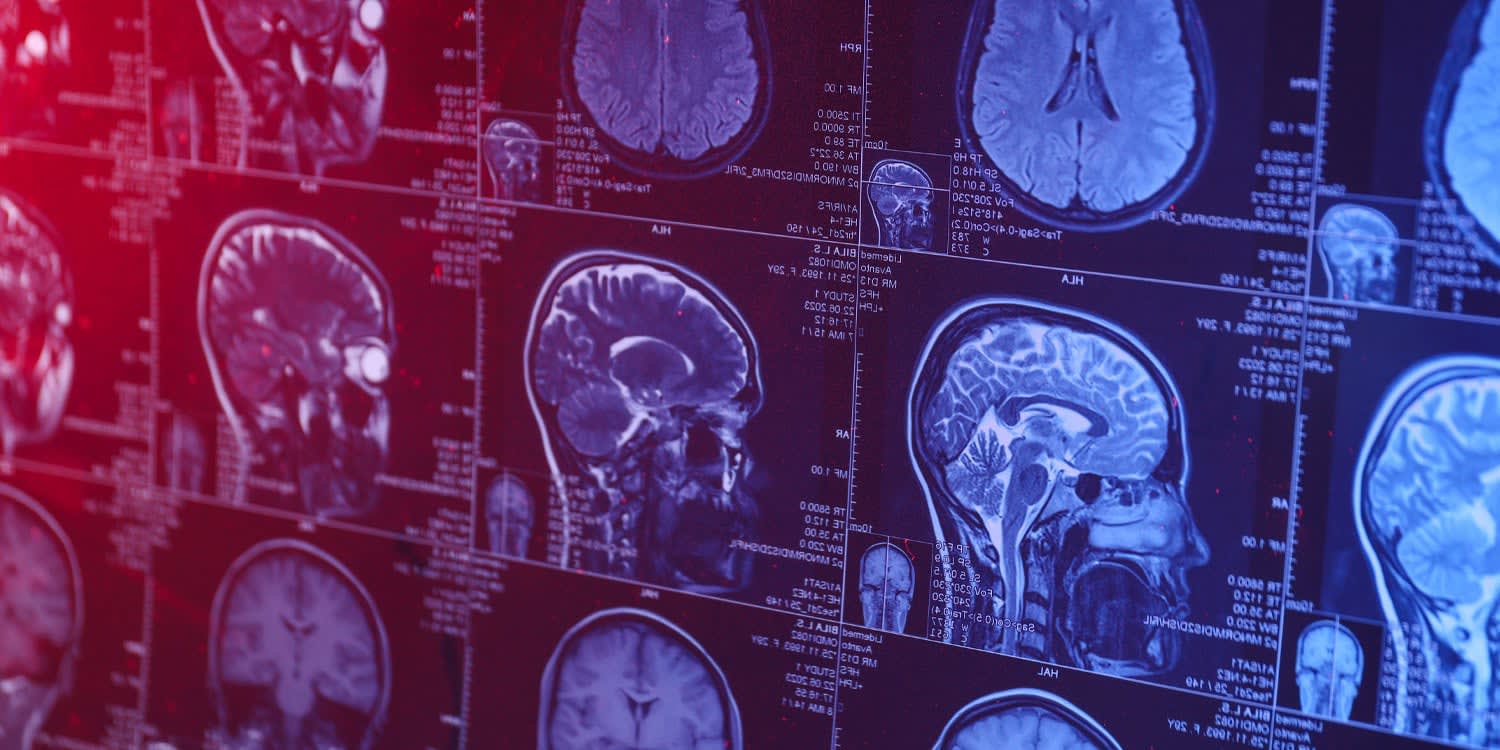 Dead at 24 from dementia – how a young man’s final gift could change ...