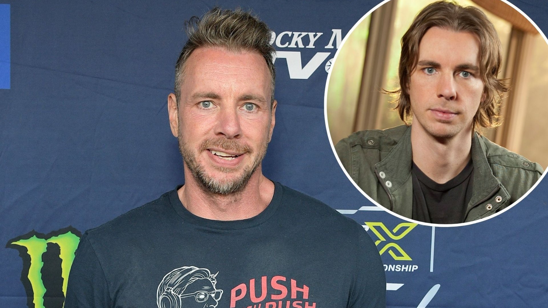 Dax Shepard admits he looks like he got 'some kind of jaw implant'