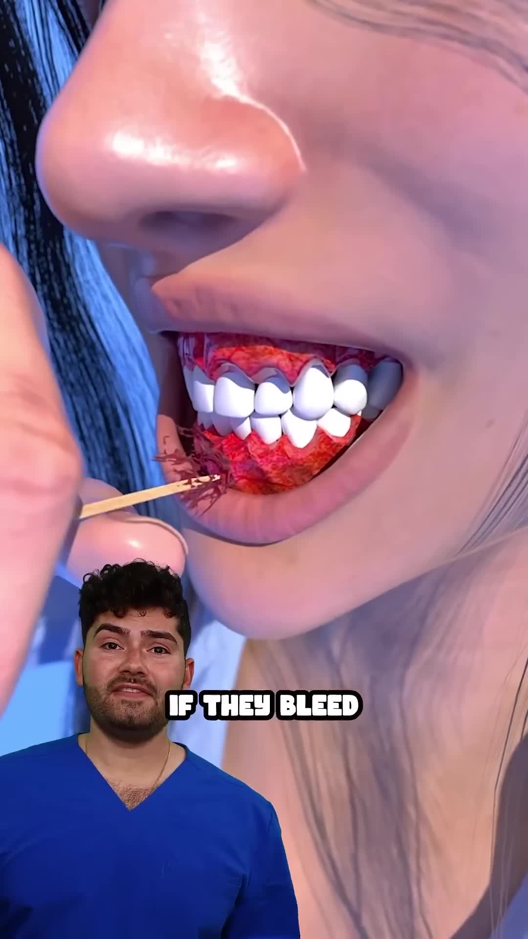 Gum Color Meaning - Dentist Explained