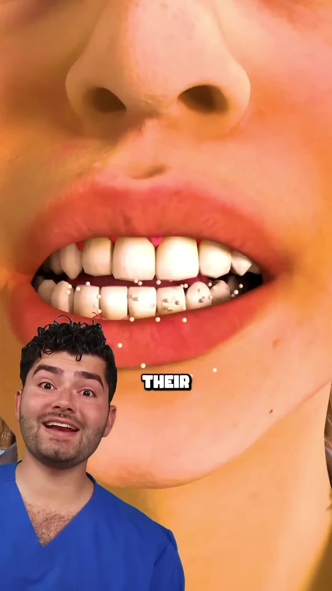 How BOTOX really works 💉