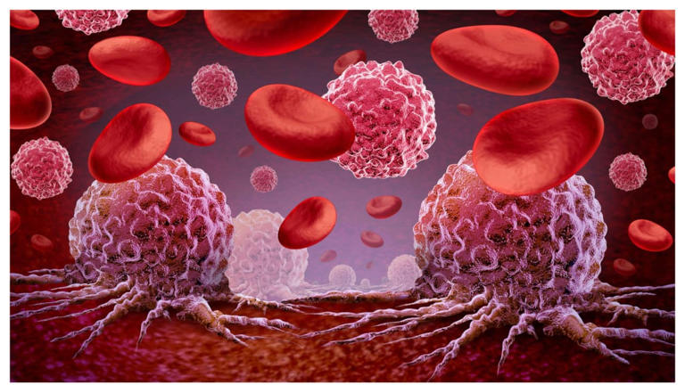 Don't brush it off: Early blood cancer clues you must notice