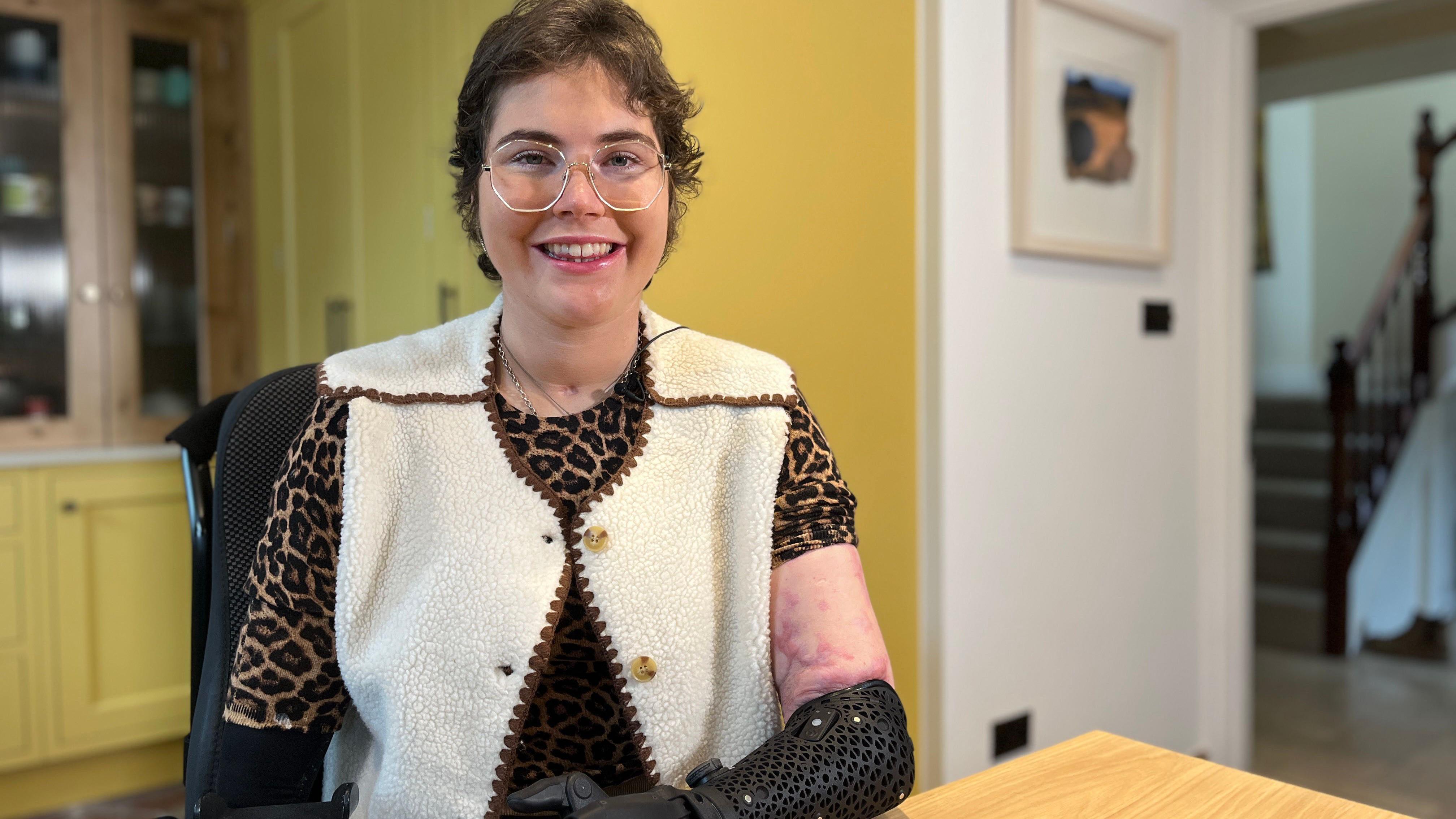 'Sigh of relief' as amputee finally returns home