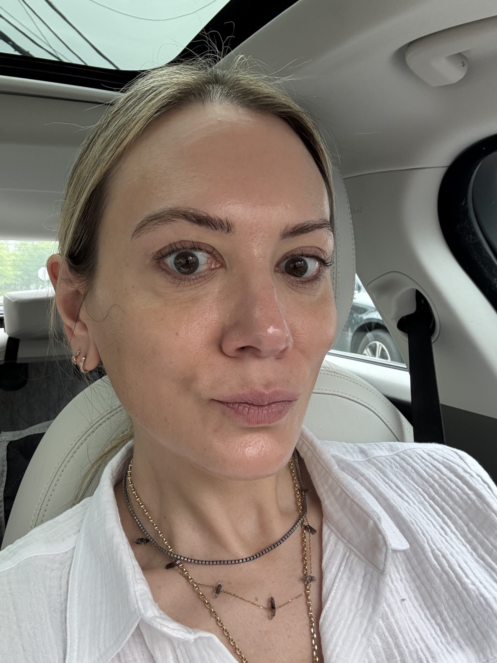 Microneedling the body for tight toned skin