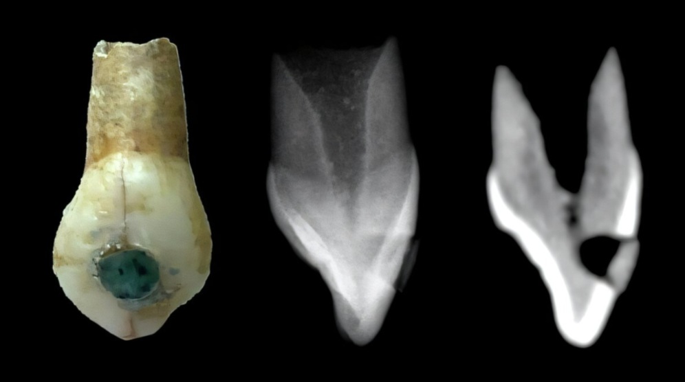 Study of ancient teeth reveals Mayan children wore priceless smiles