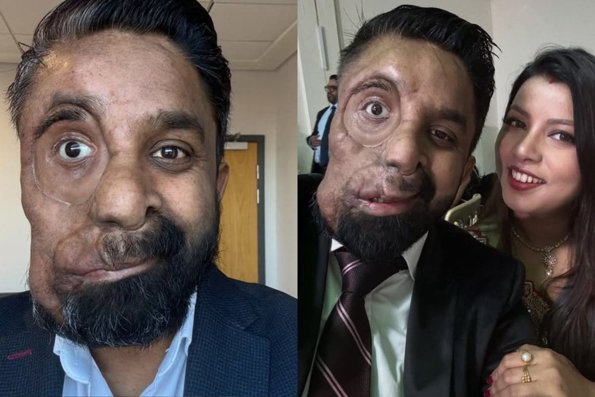 Born with rare condition, he underwent 26 surgeries. Strangers still ...