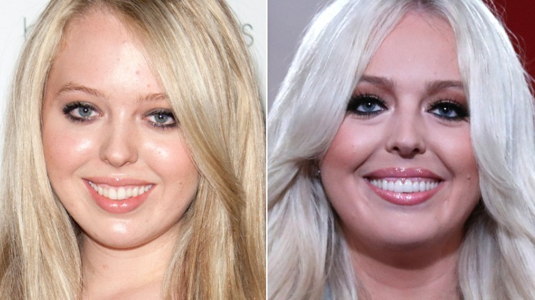 Side-by-side pics of Tiffany Trump's teeth transformation hint her ...