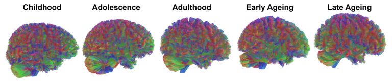 Scientists identify five distinct phases of brain structure across the ...