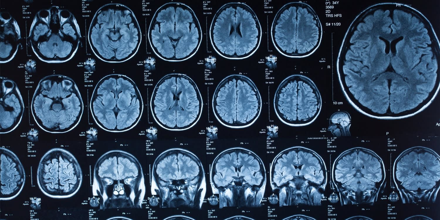 Scientists identify five distinct phases of brain structure across the ...