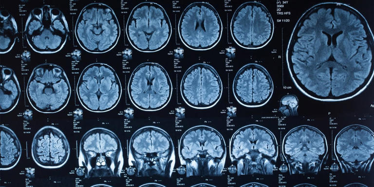 Scientists identify five distinct phases of brain structure across the ...