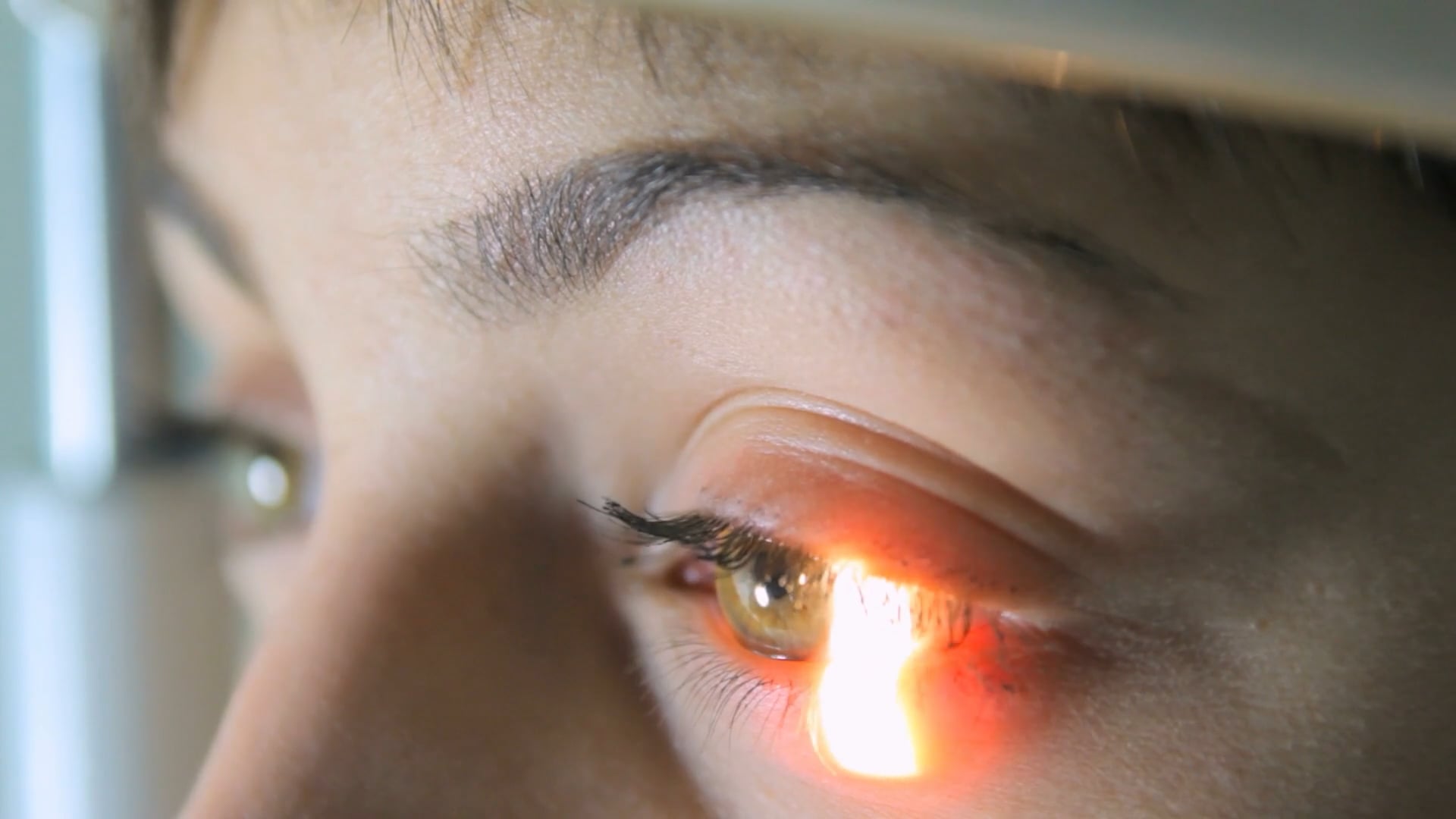 Dark spots floating in your eyes: when to worry and when to relax