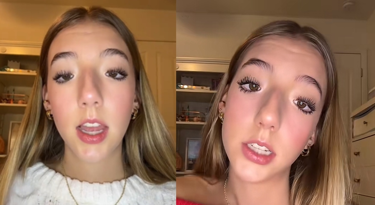 «Mi chiamo Sabrina, sono nata con ptosi congenita: per questo ho gli ...