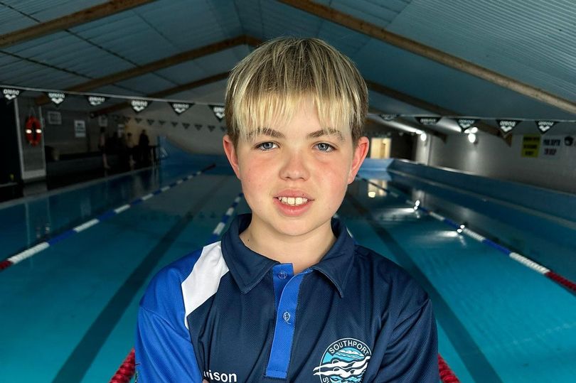 Schoolboy believed his swollen face was due to allergies before a ...