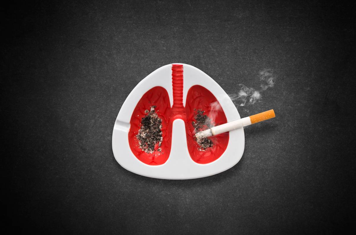 Casos de cancro deverão aumentar substancialmente: saiba o que deve ...