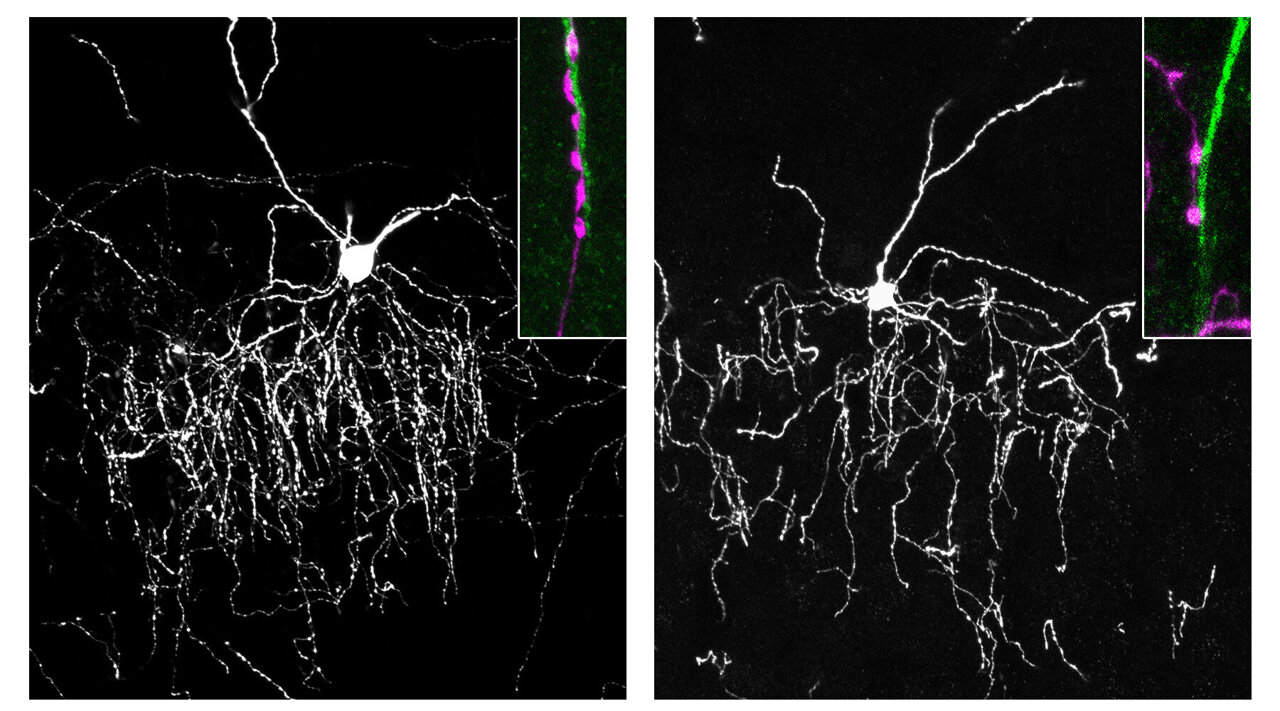 One way brain 'conductors' find precise connection to target cells