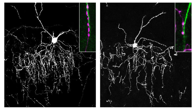 One way brain 'conductors' find precise connection to target cells