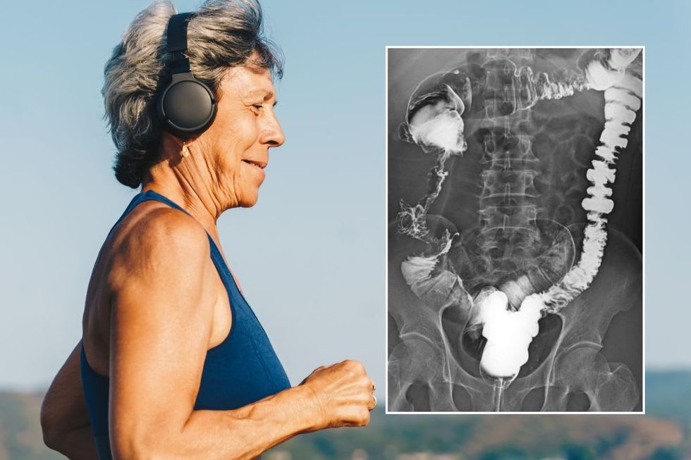 Just 10 minutes of vigorous exercise shown to create 'hostile ...