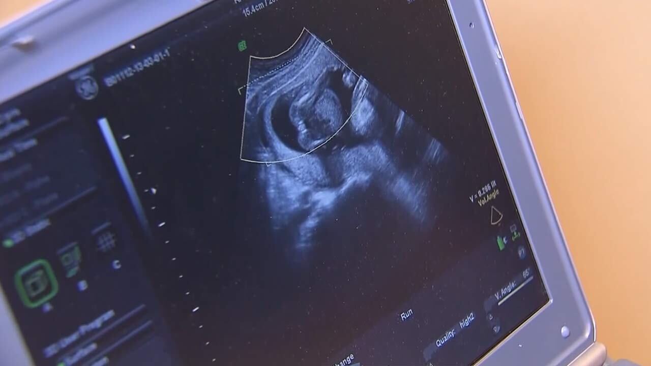 Watch live: 2 SC lawmakers to introduce new abortion policy law