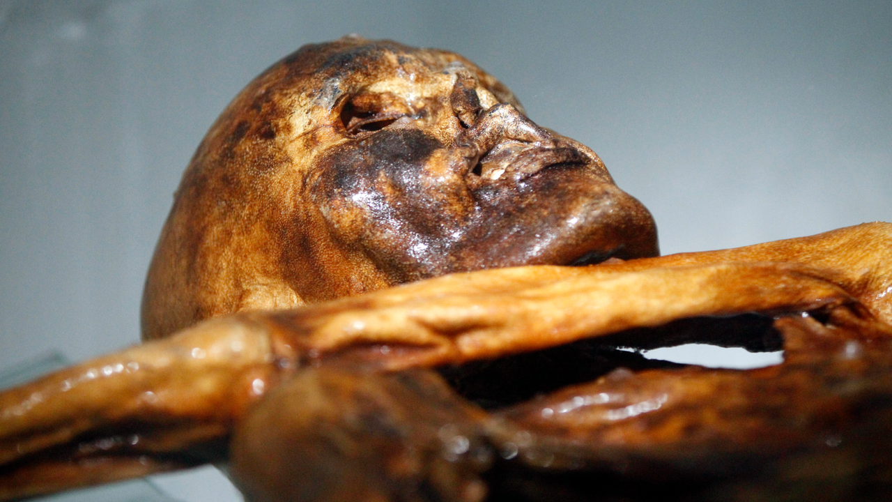 Ötzi the Iceman mummy carried a high-risk strain of HPV, research finds