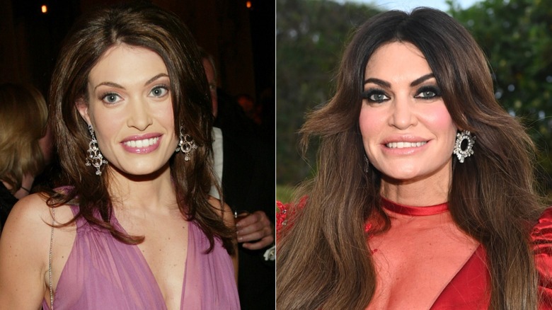 12 MAGA women with the most dramatic before-and-after transformations