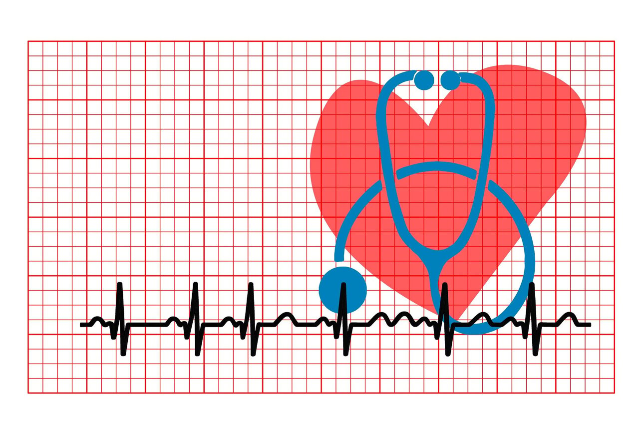 Abnormally slow heart rate associated with xylazine-fentanyl overdose