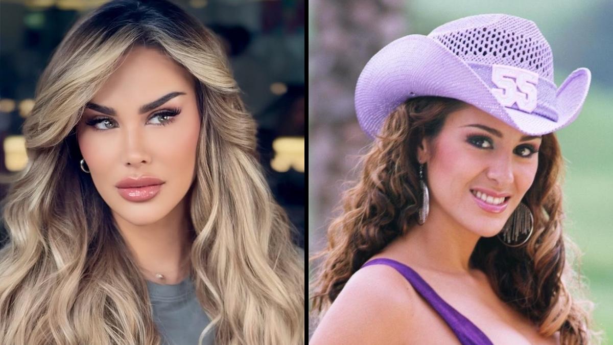 Así se veían las famosas antes de sus cirugías estéticas