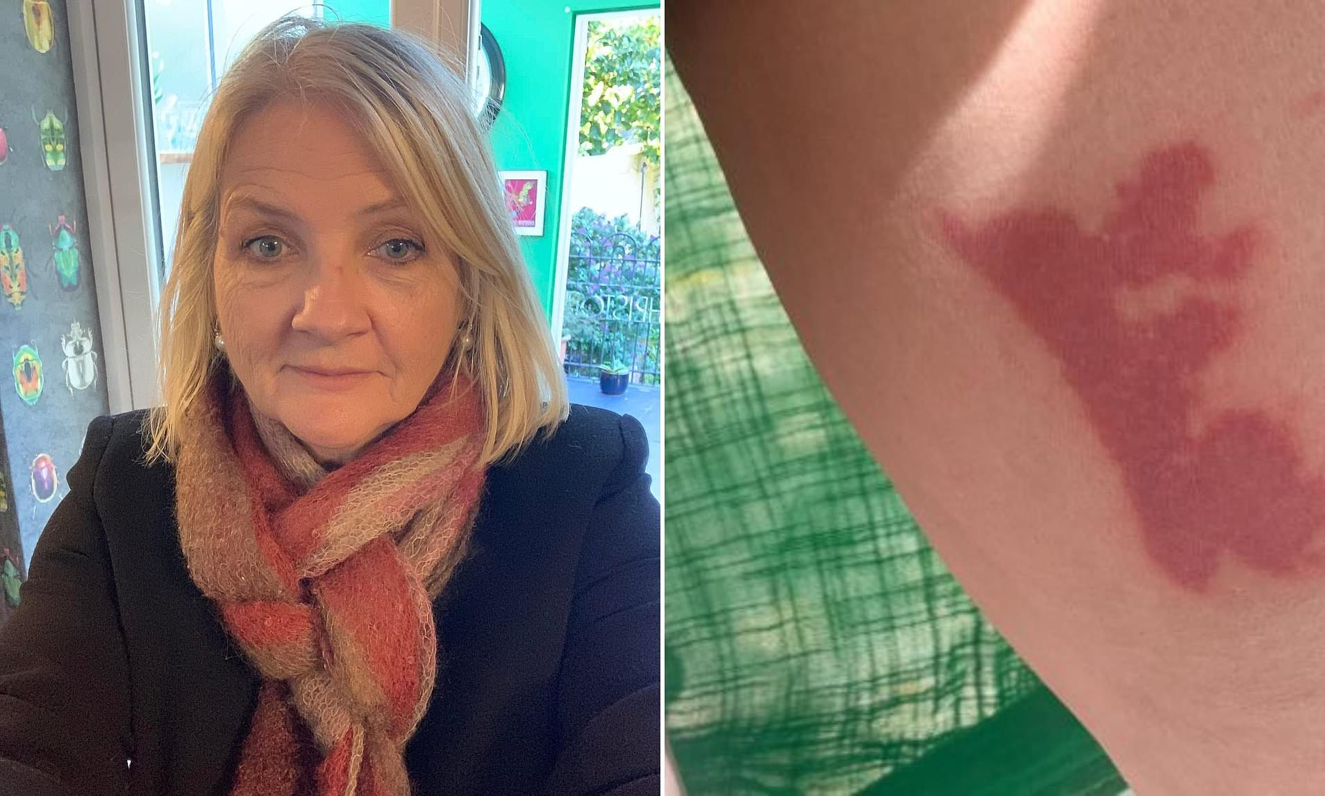 Ryanair passenger left with serious burns after hot drink slid off a ...