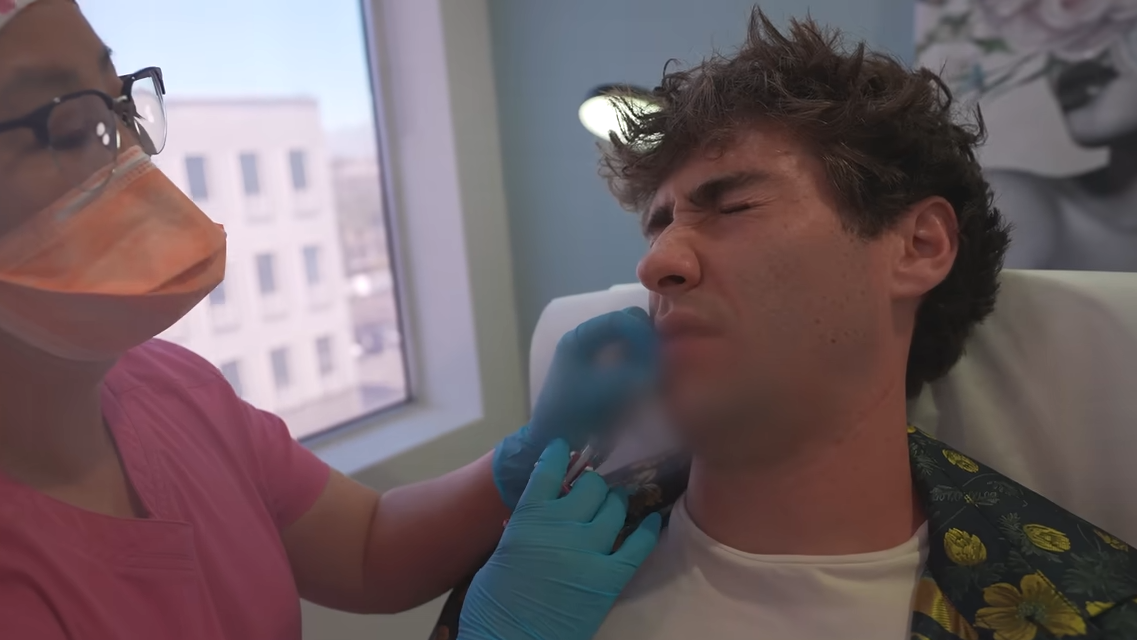 My lips are so numb - This man let a stranger inject his lips