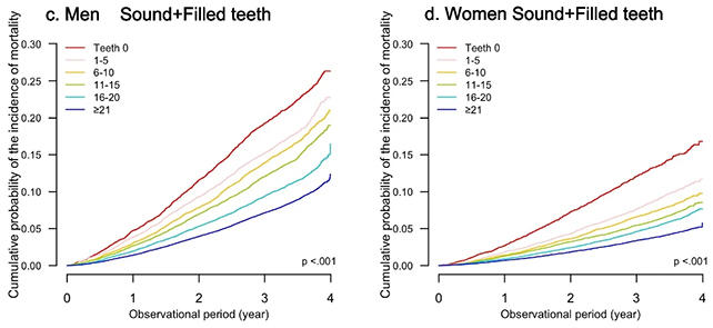 The state of your teeth could predict an early death, study shows