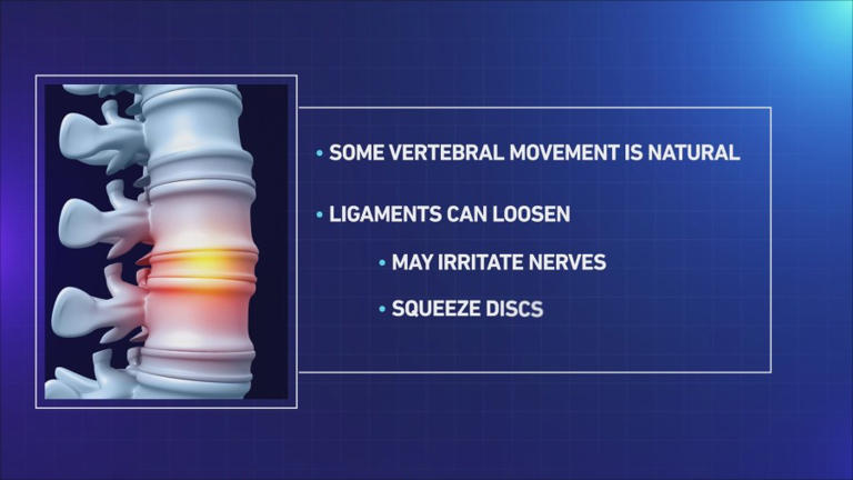 Specialized X-ray helps pinpoint cause of back pain, offering hope for ...