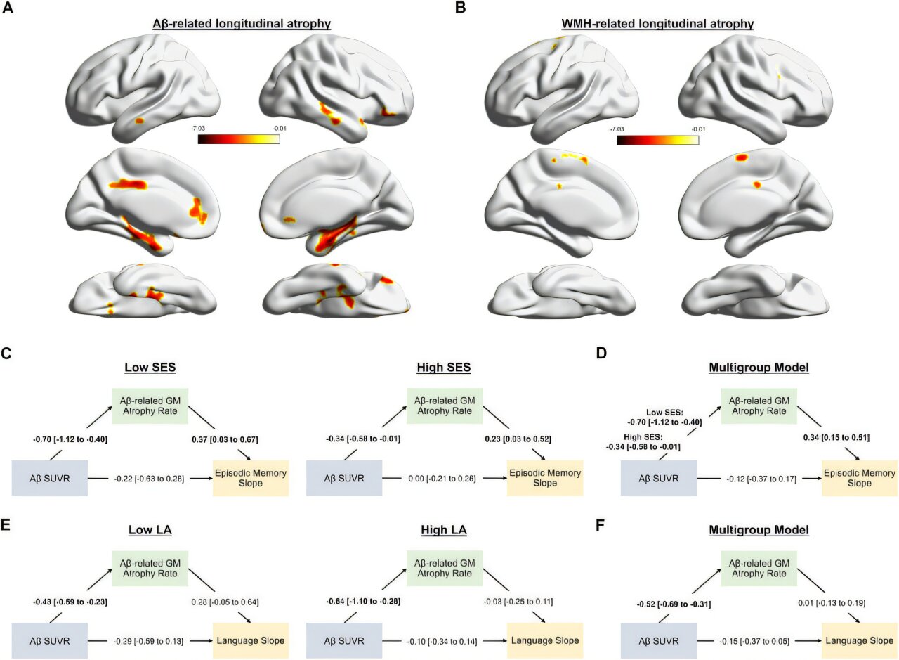 Personalized prevention strategies may lower Alzheimer's risk by ...