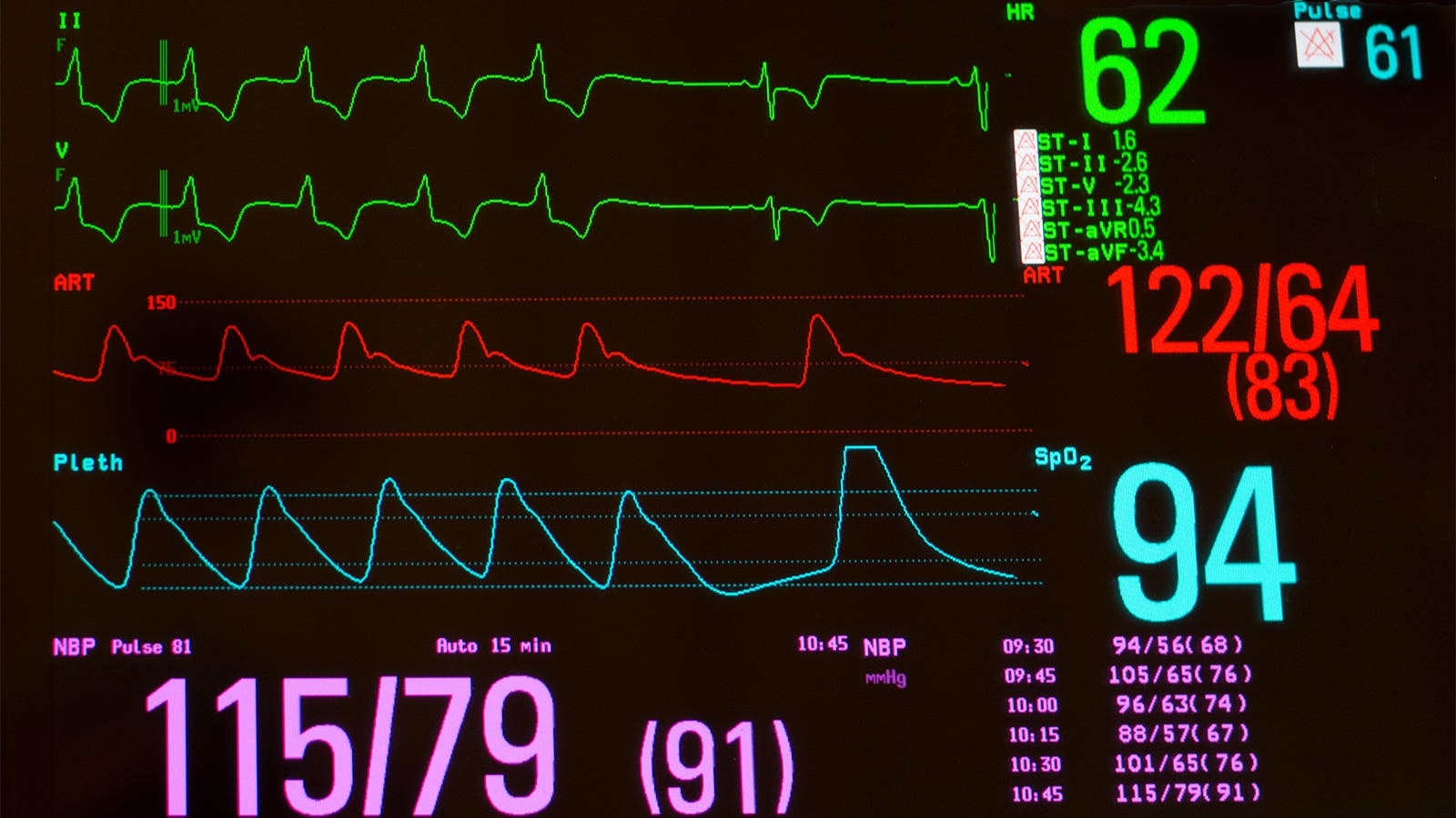 Slow heart rate may signal xylazine involvement in opioid overdoses