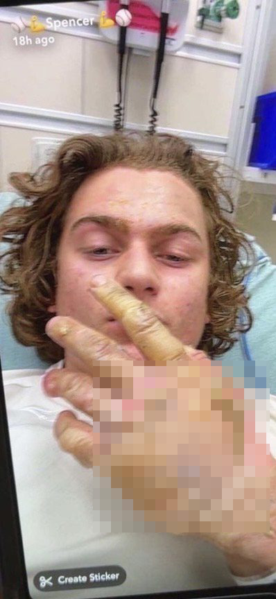 Teen accused of torching Mississippi synagogue posted gruesome selfie ...