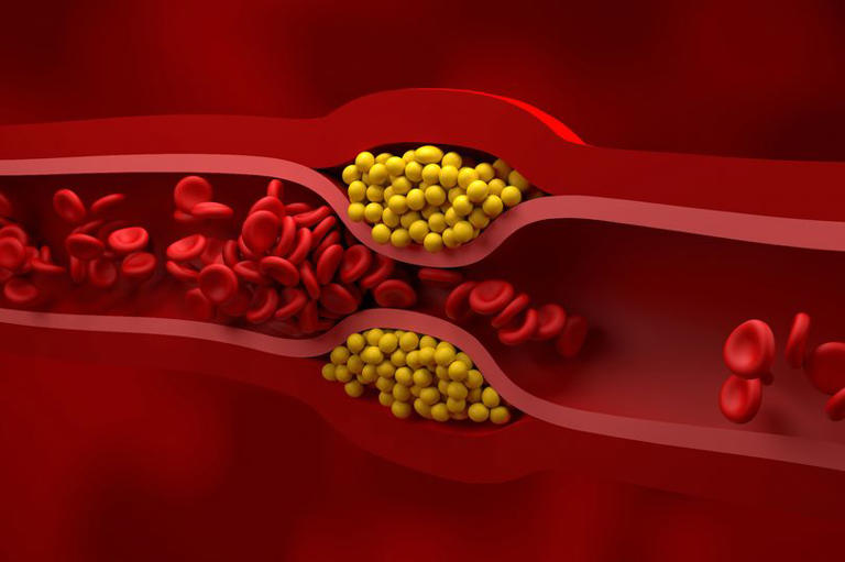 Cholesterol levels could be lowered in four weeks by 95p fruit